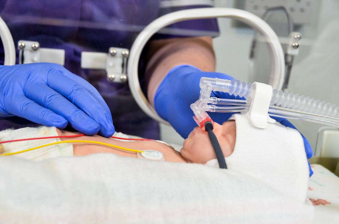 Mascaras y Prongs nasales NeoFlow nCPAP – WP Soluciones